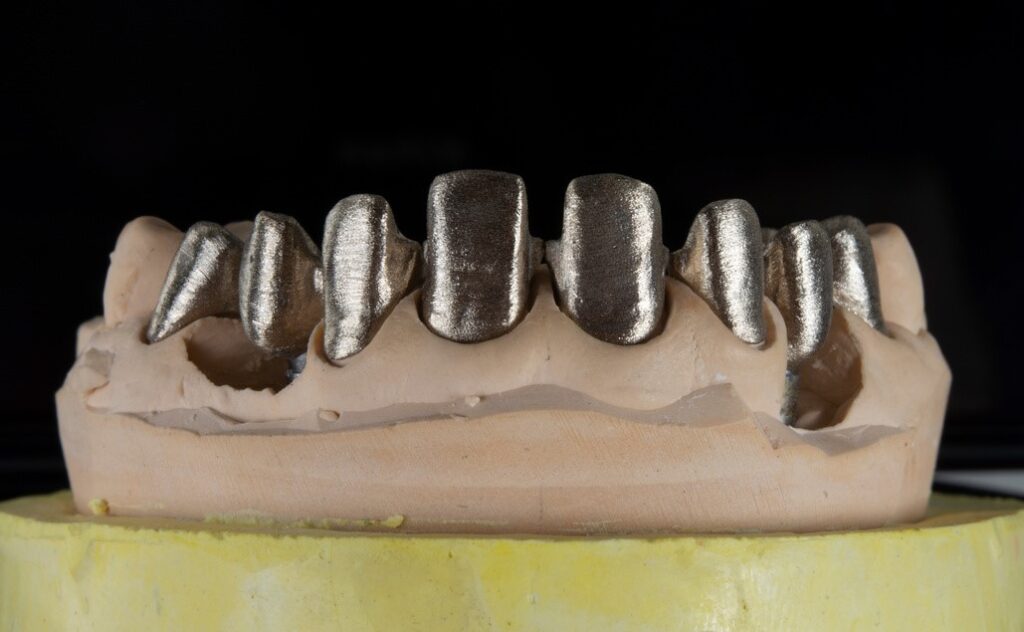 Precious metal restorations - HT Dental ART