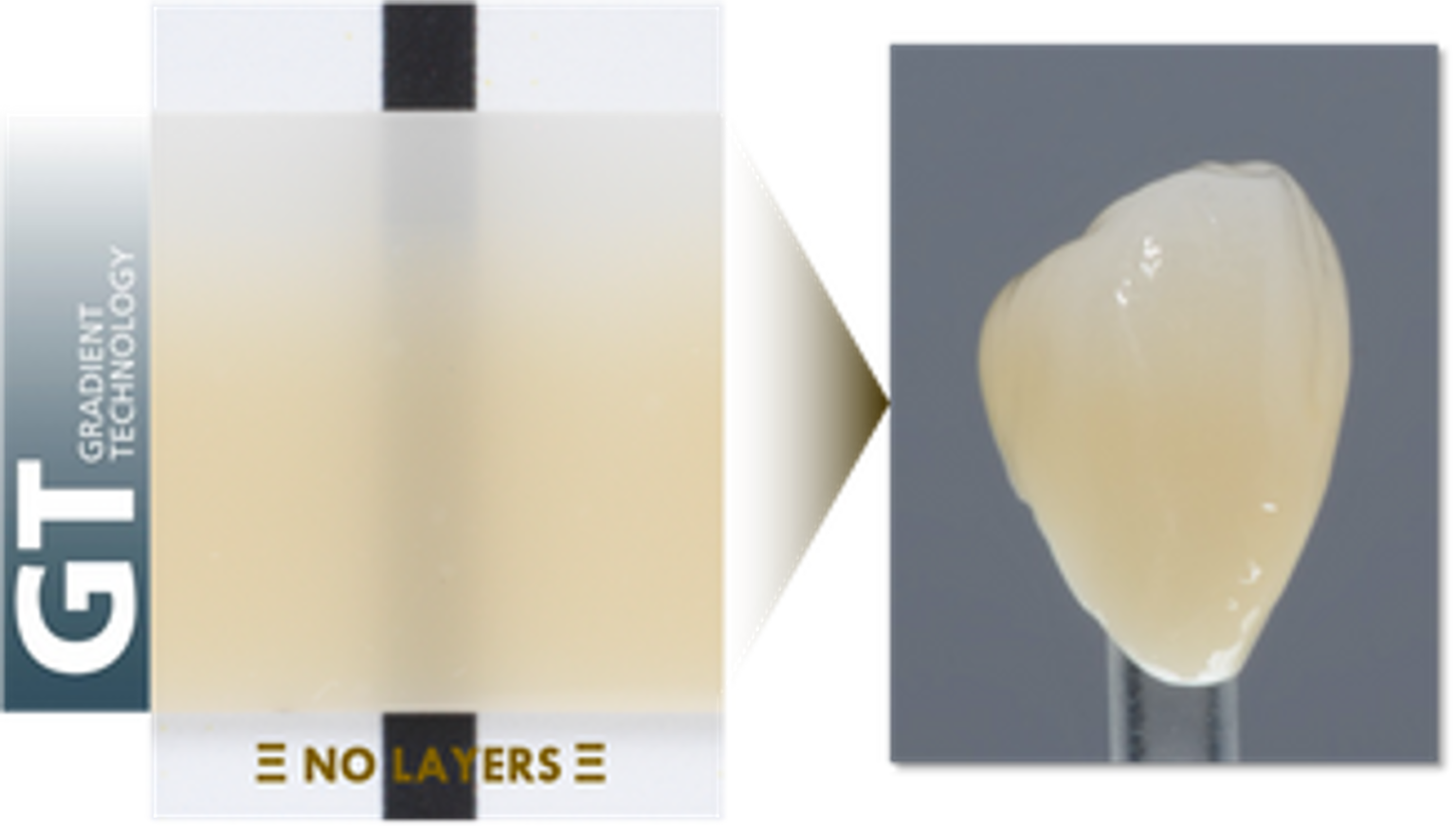 Advantages of ZirCAD Prime Monolithic Restorations - HT Dental ART