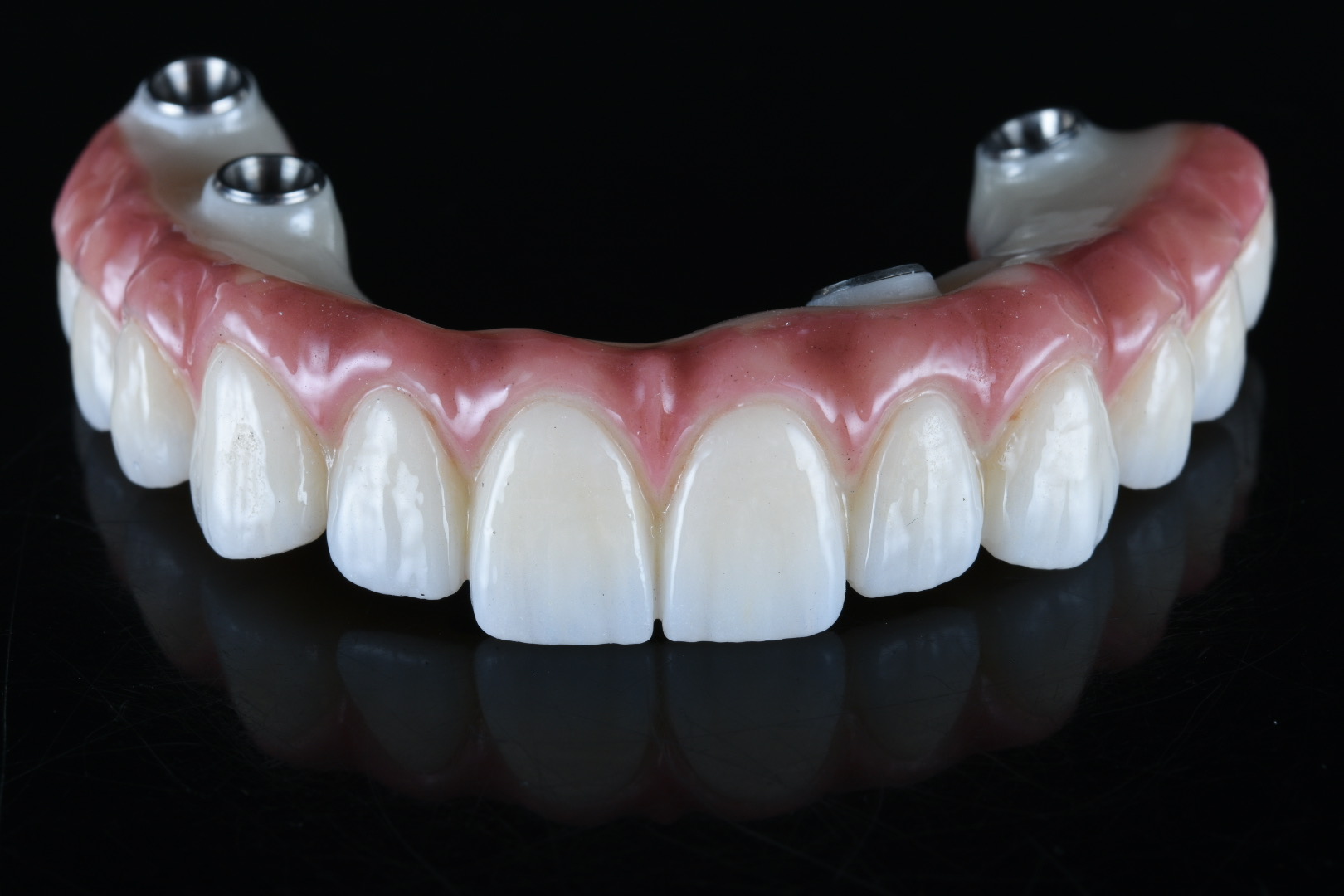 THE UTIMATE SOLUTION FOR FULL-ARCH IMPLANT RESTORATION - HT Dental ART
