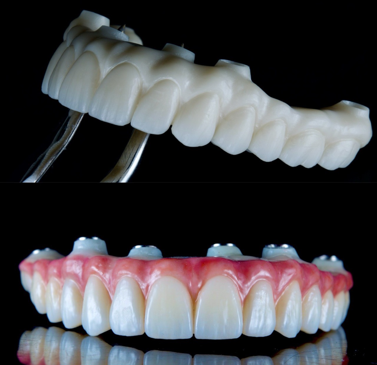IPS E.MAX ZIRCAD PRIME – THẨM MỸ MÀ BỀN VỮNG - BÍ MẬT CỦA PHỤC HÌNH ...